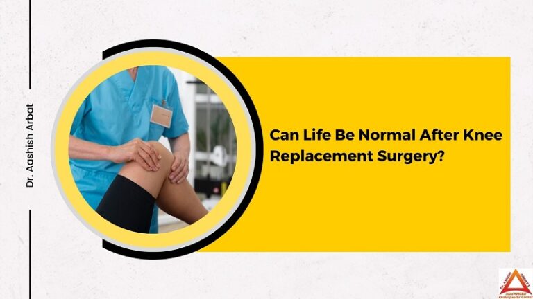Can Life Be Normal After Knee Replacement Surgery